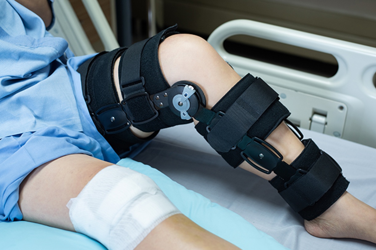 Limb Salvage/Preservation | Department of Plastic Surgery