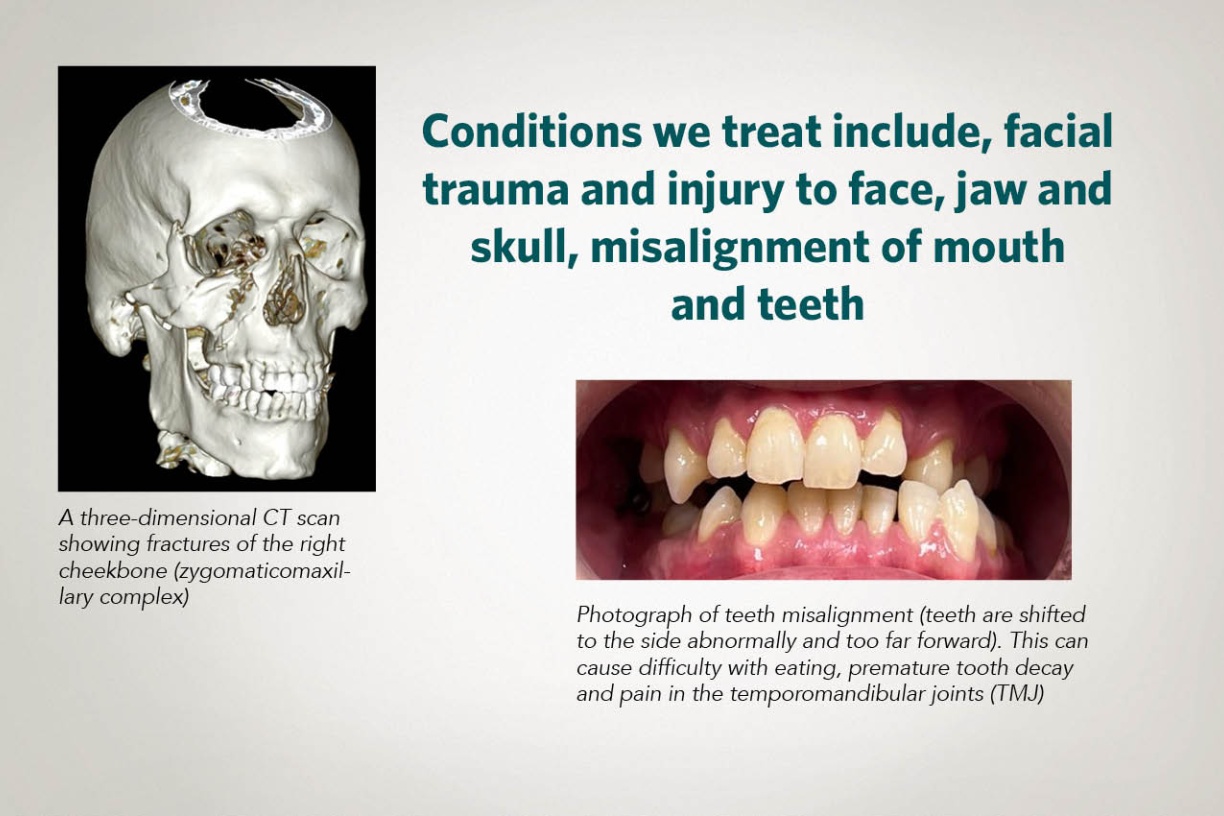 Adult Cleft and Craniofacial Program | Department of Plastic Surgery