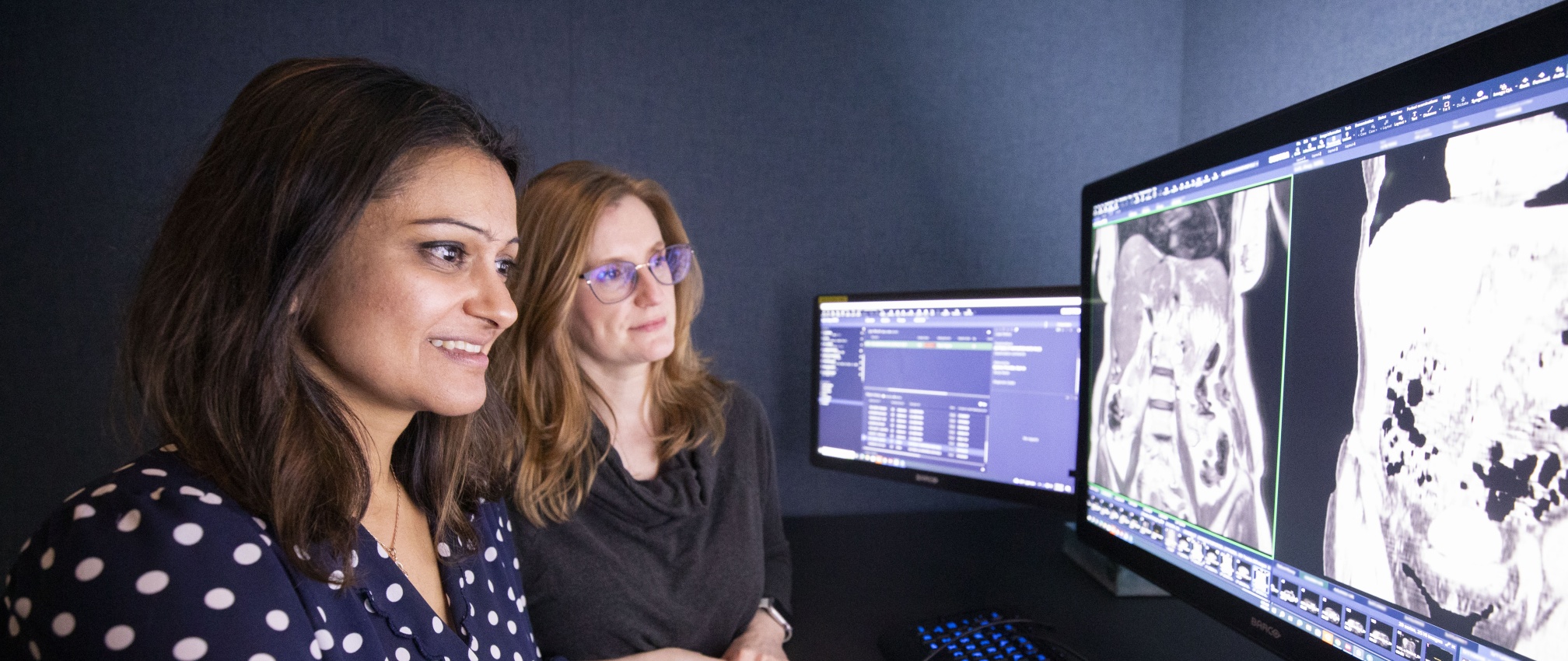 Abdominal Imaging | Department of Radiology