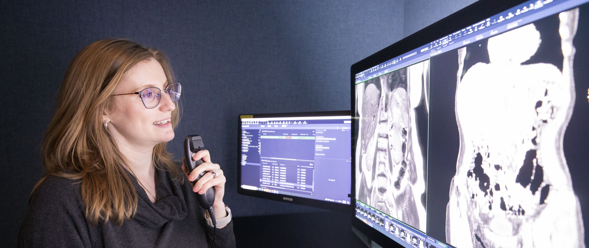 Abdominal Imaging | Department of Radiology