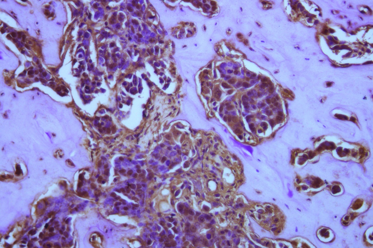 Rachelle W. Johnson, PhD | Vanderbilt Center for Bone Biology (VCBB)