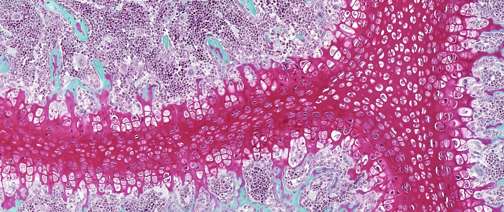 Program | Vanderbilt Center for Bone Biology (VCBB)